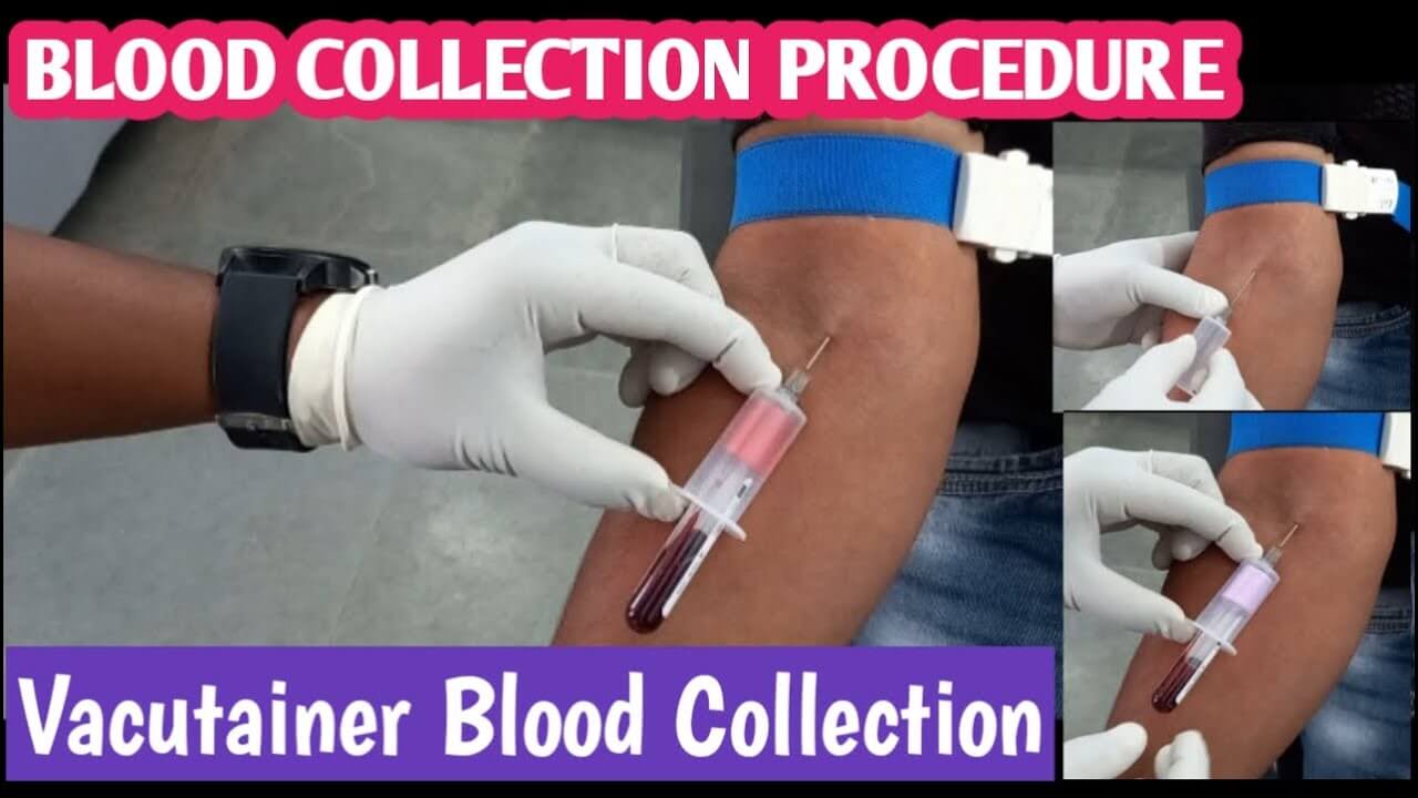 Blood Collection Tube - The basics - Pammvi Group Of Companies